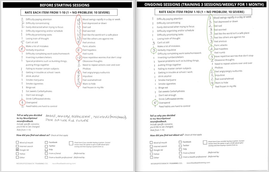 How Many Neurofeedback Sessions Do I Need?