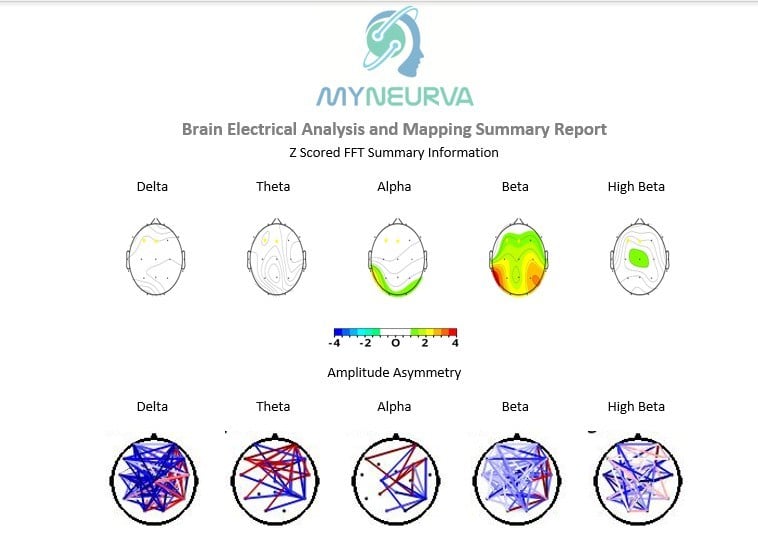 Best Home Neurofeedback Systems: What Are Your Options?