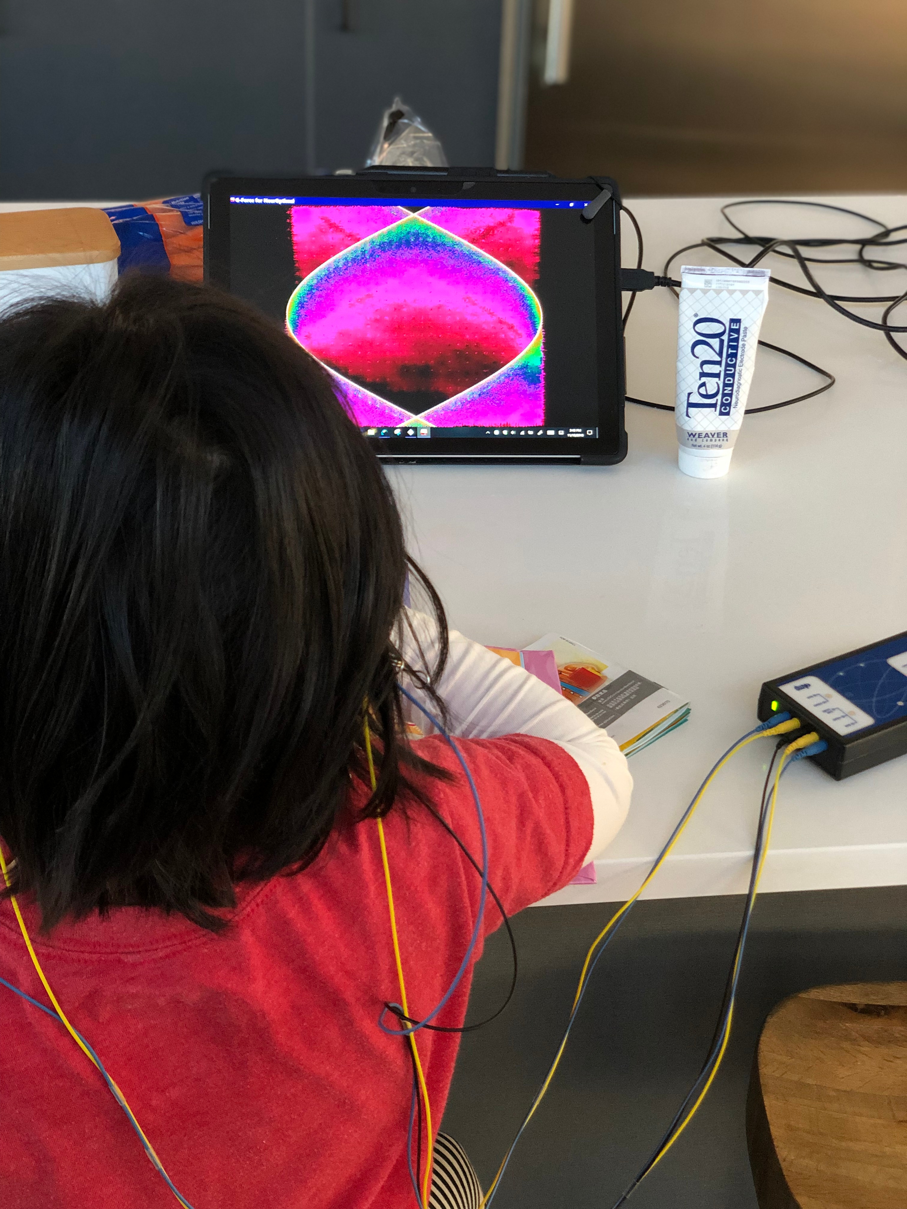 What Is the Cost of NeurOptimal®?